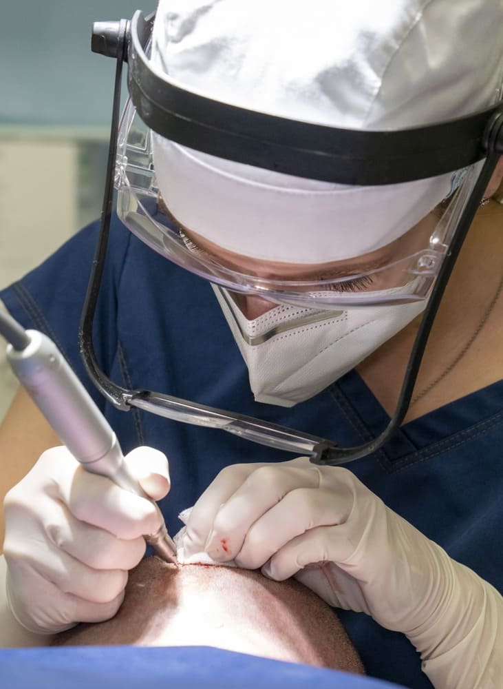 Greffe de cheveux sans rasage : fausse bonne idée